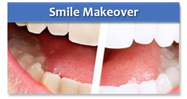Smile Makeover West Sussex | Dental Healthcare Practice